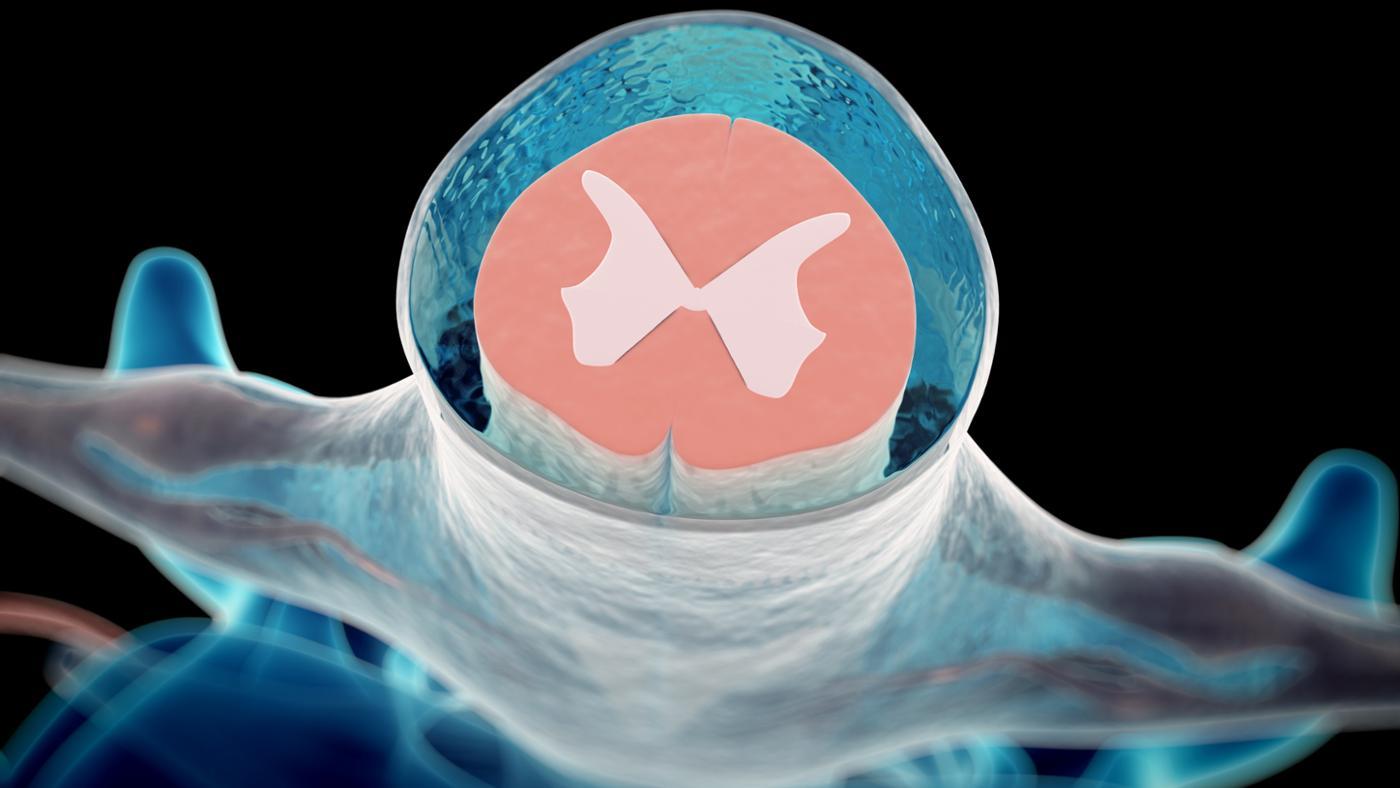 What Is a Ventral Thecal Sac?