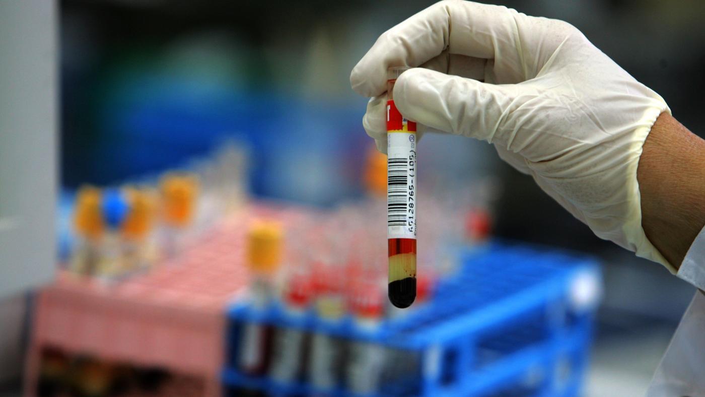 What Does the TSH 3rd Generation Test Mean?