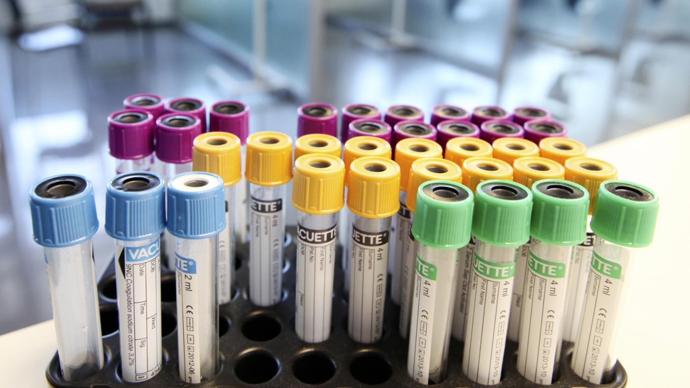 What Are the Uses of a Test Tube Rack?