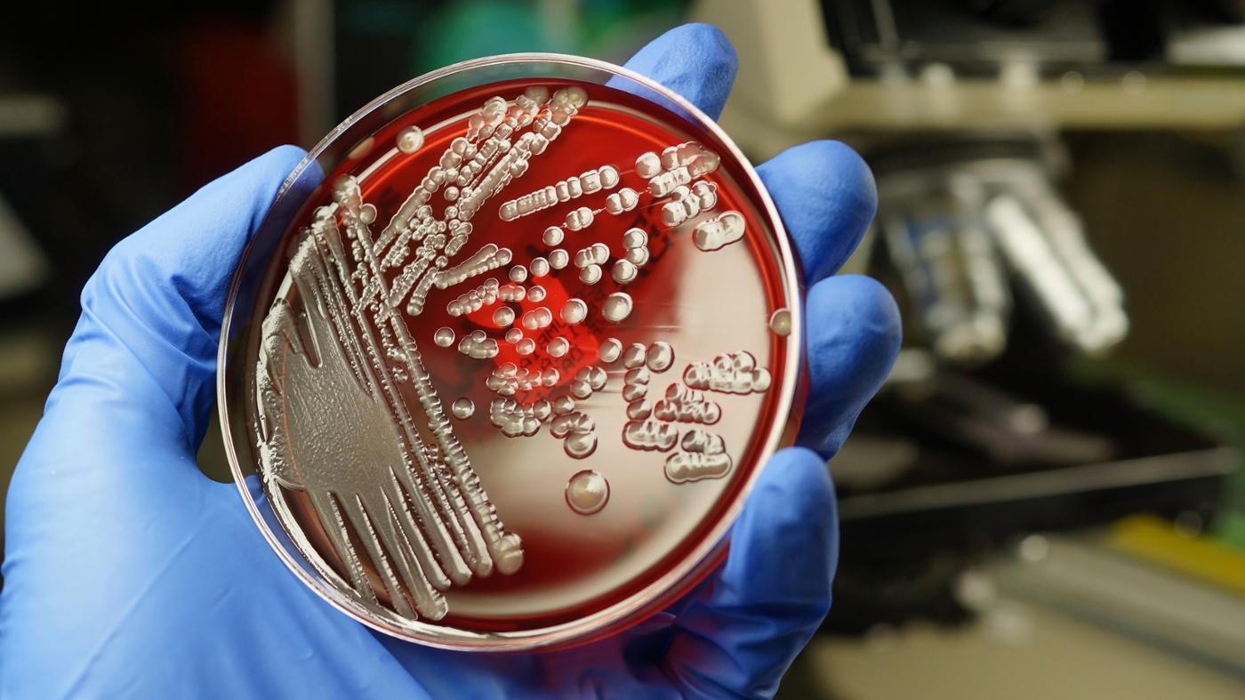 What Is the Symbiotic Relationship Between E. Coli and Humans?