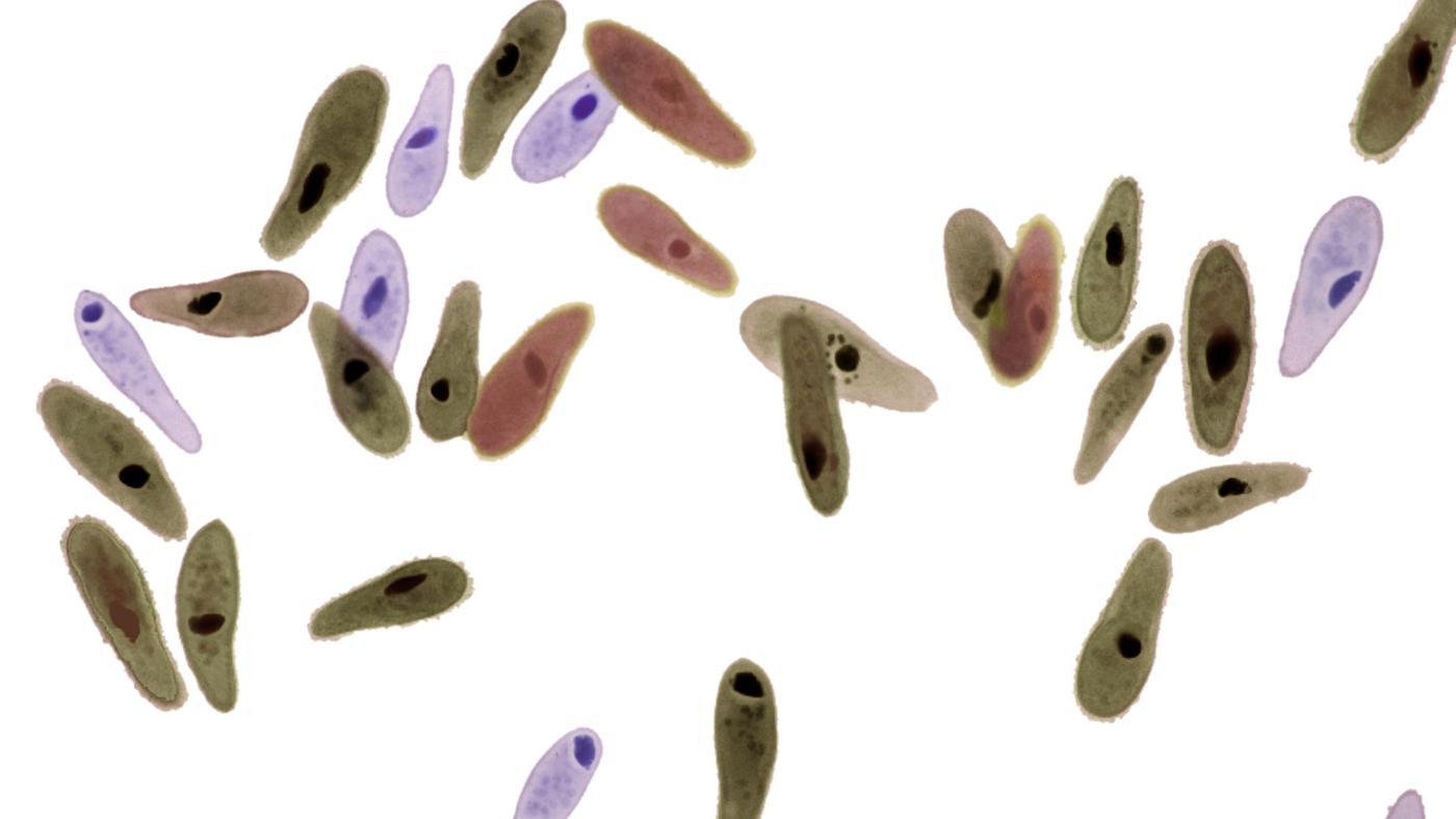 What Diseases Are Caused by Paramecium?