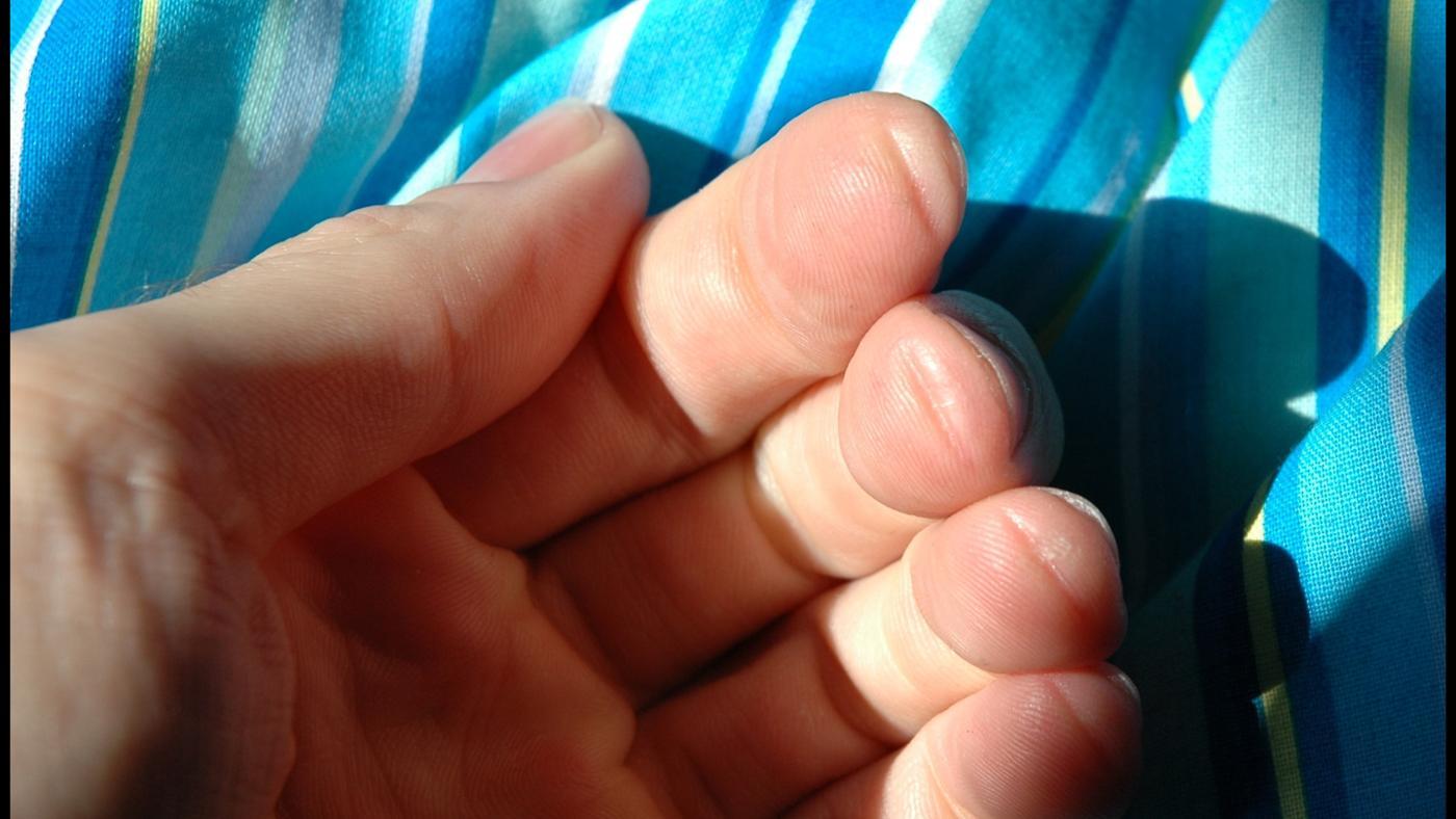 What Causes Skin Indentations?