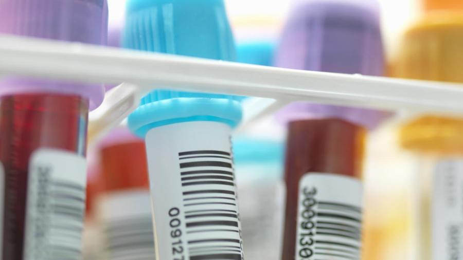 What Color Tube Is Used for a BMP Lab Test, and How Much Blood Is Used?