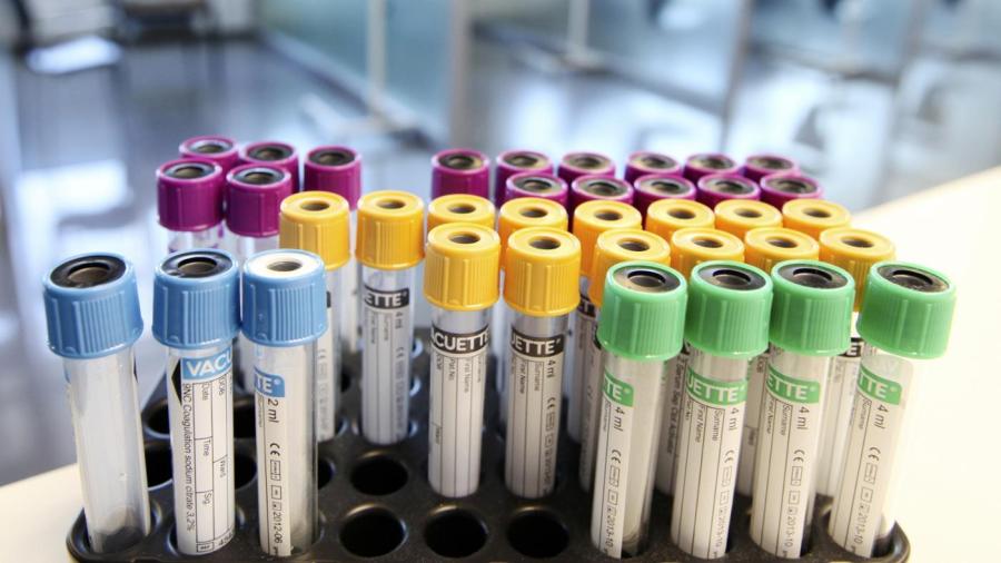 What Are the Uses of a Test Tube Rack?