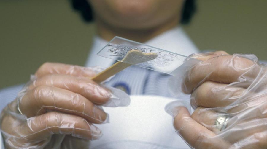 What Instruments Are Used for a Pap Smear?