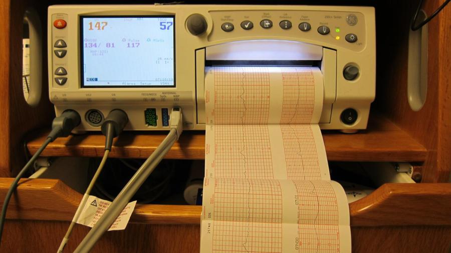 What Is TOCO Fetal Monitoring?