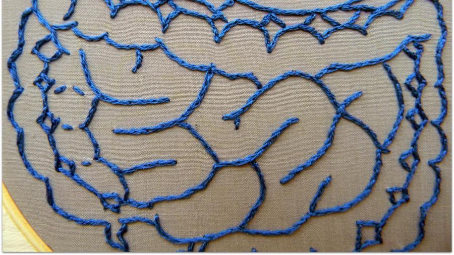 What Is the Function of Rugae in Stomach?